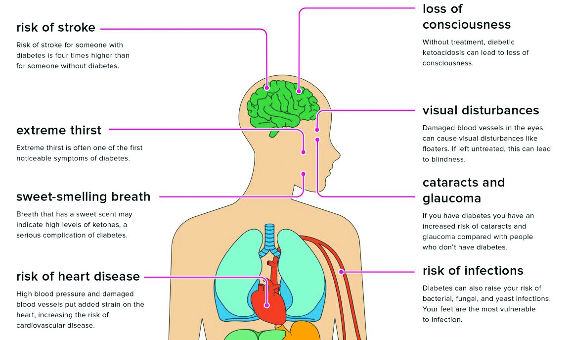Diabetes - The High Blood Sugar Disease - Vanguard Allure