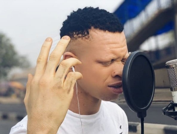 Meet YellowCee, Nigeria’s ‘First Albino Rapper’ Likened To Dagrin ...