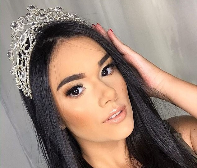 Brazilian beauty queen, 21, dies during surgery to remove a tumor near ...