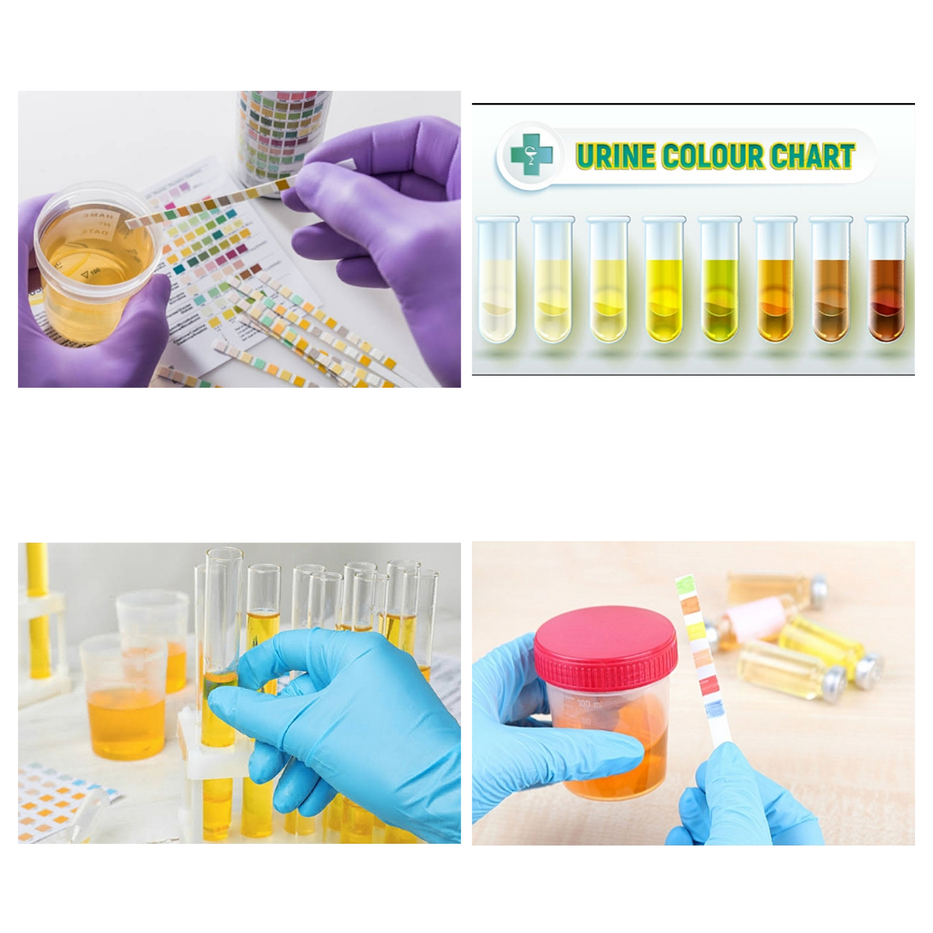 What your urine colour, odour say about your health - Vanguard Allure